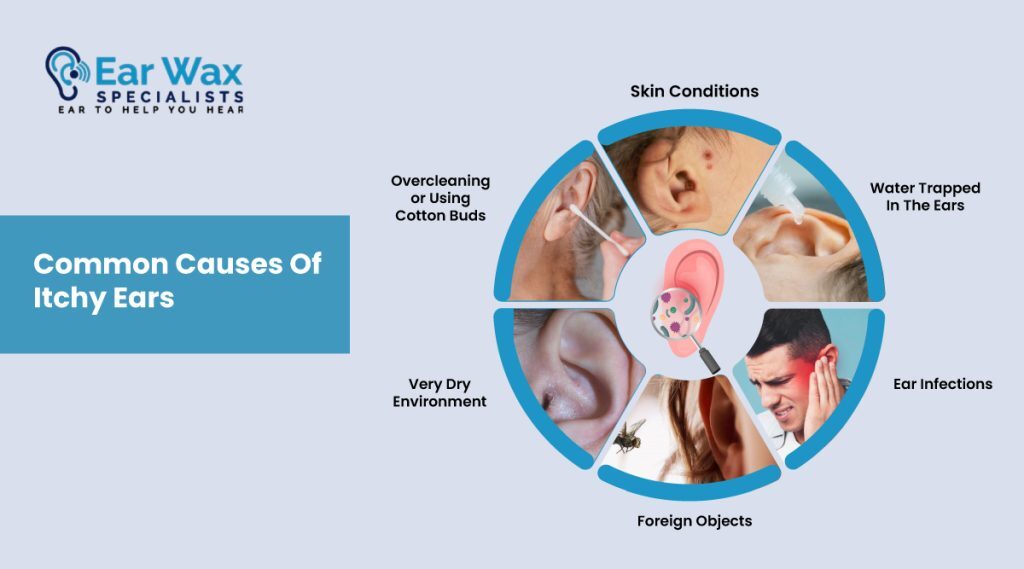 Itchy Ears, Causes, Symptoms & Best Treatments - Ear Wax Specialist